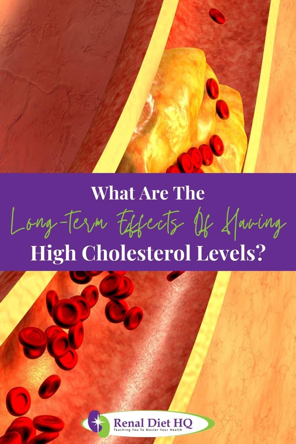 Blood Lipid Levels For CKD - RDHQ
