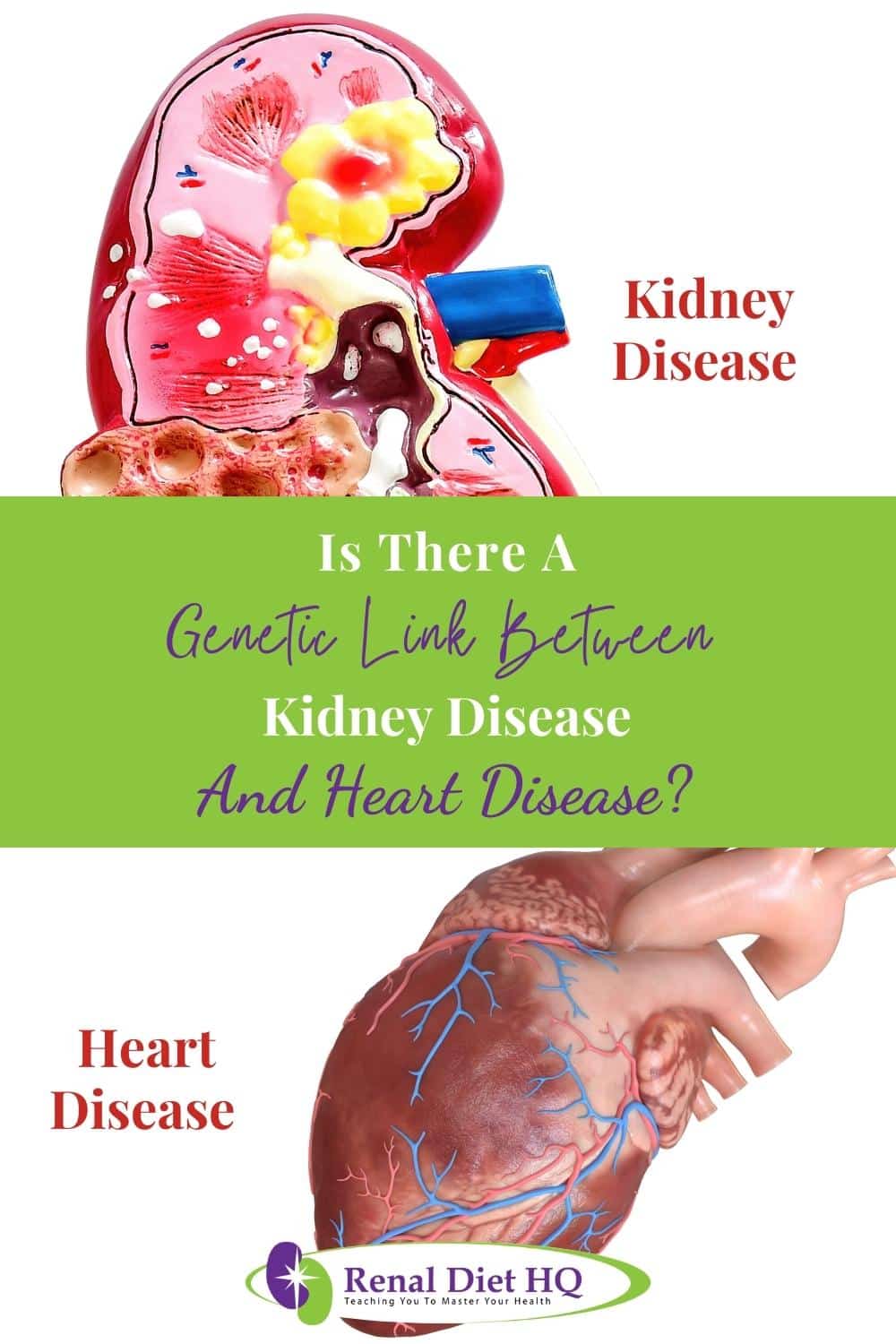 CKD Complications that Can Increase your Risk of Heart Disease - RDHQ